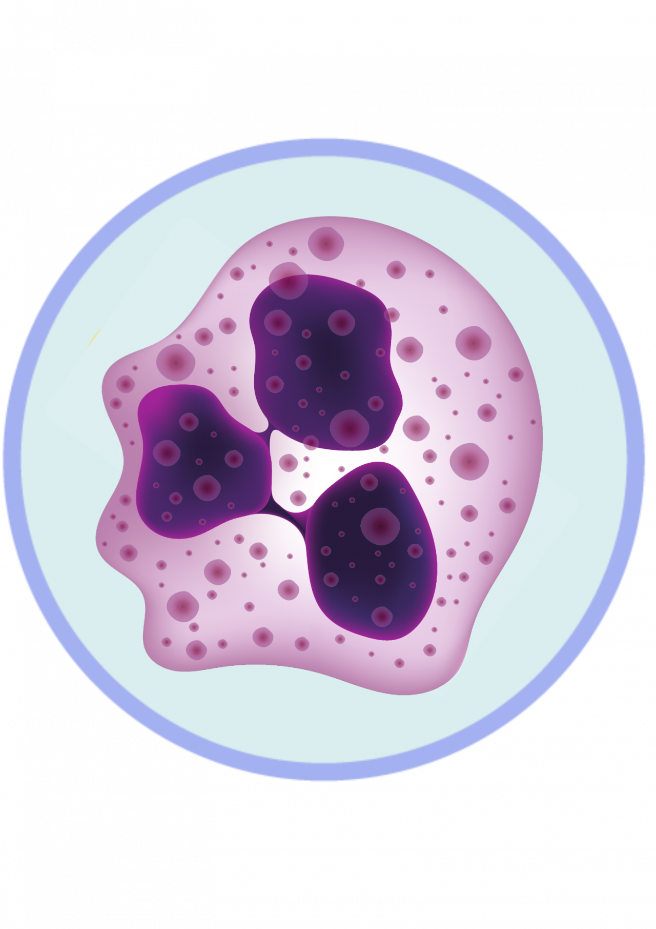 Classifications | IBD-EII