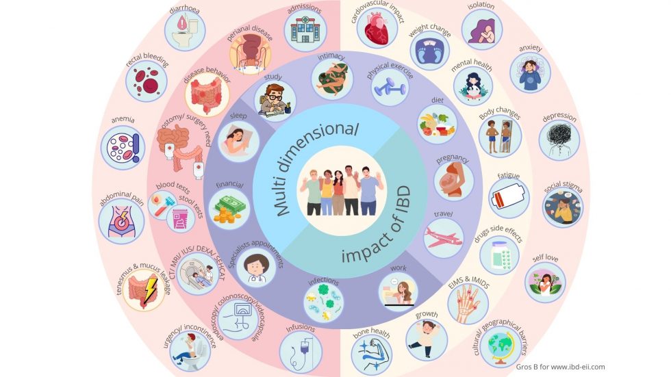 IBD cheat sheet | IBD-EII
