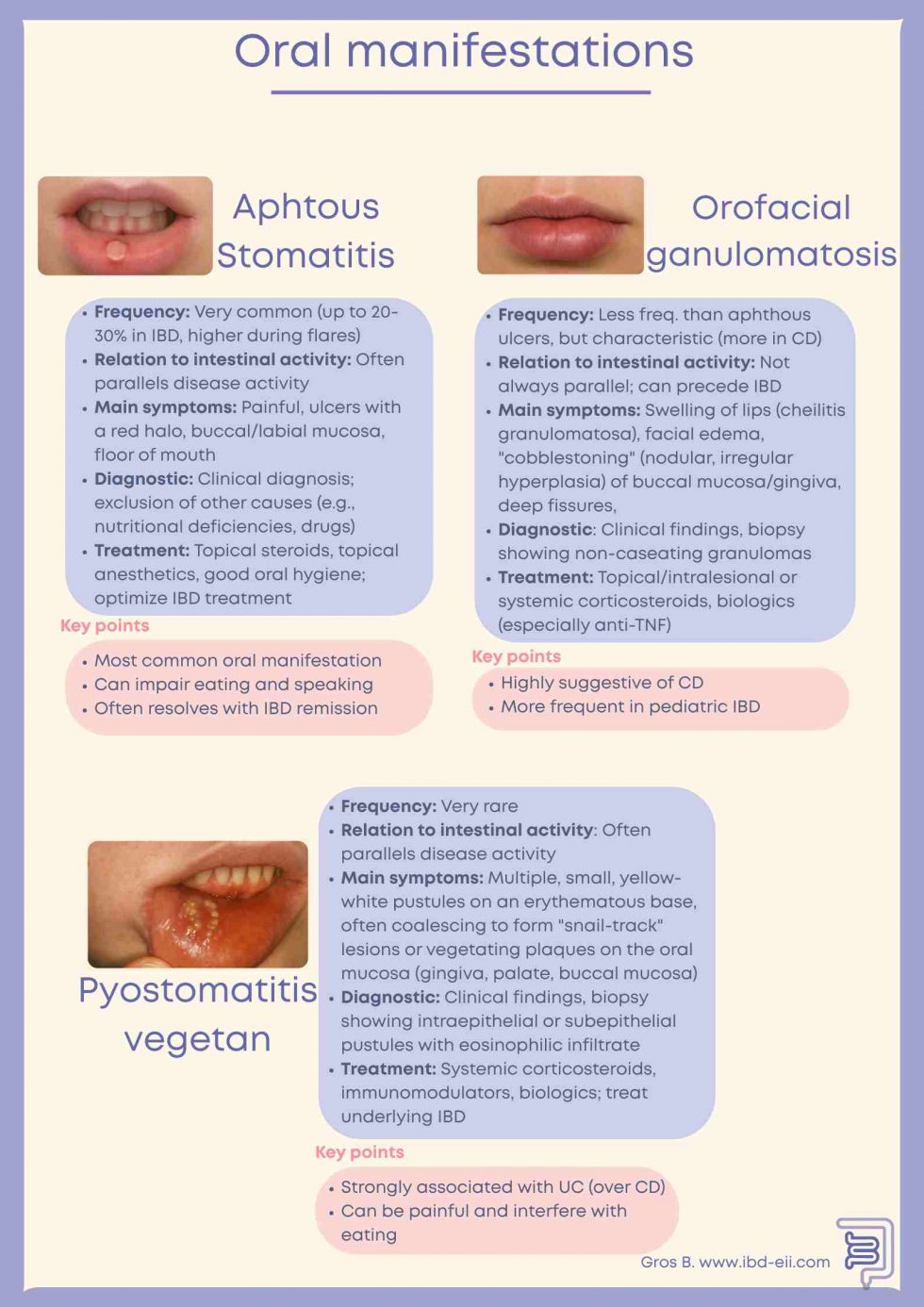 IBD cheat sheet | IBD-EII