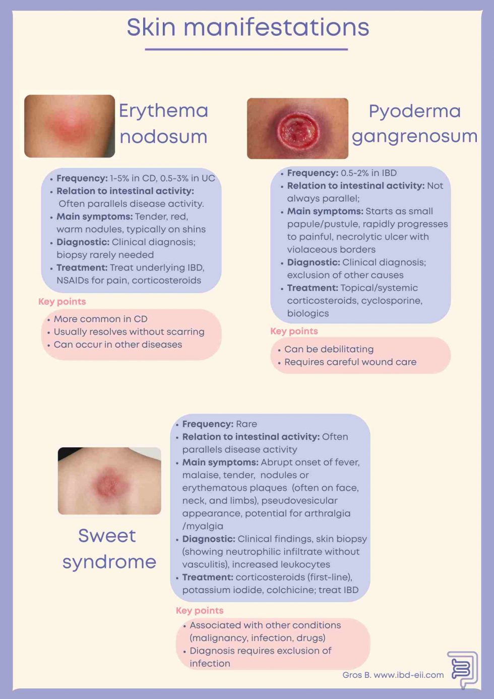IBD cheat sheet | IBD-EII